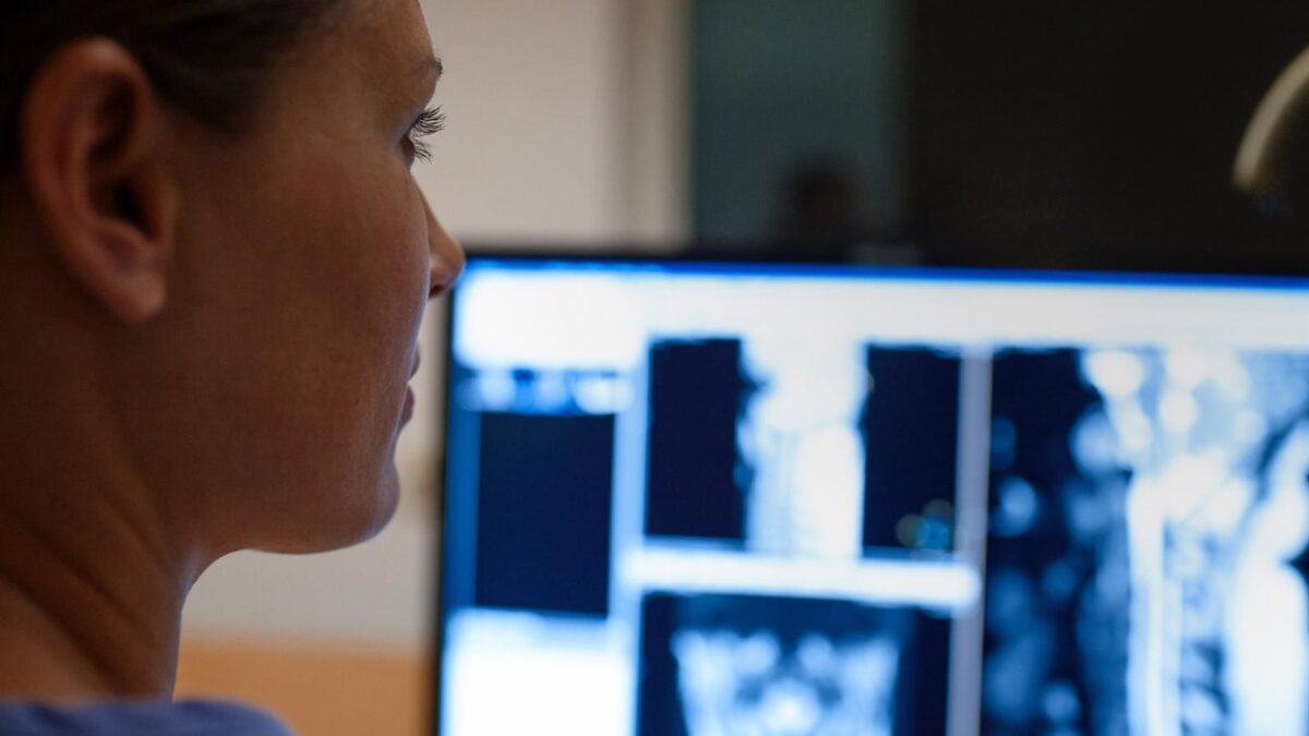 Philips une fuerzas con AWS para llevar su solución HealthSuite Imaging ...